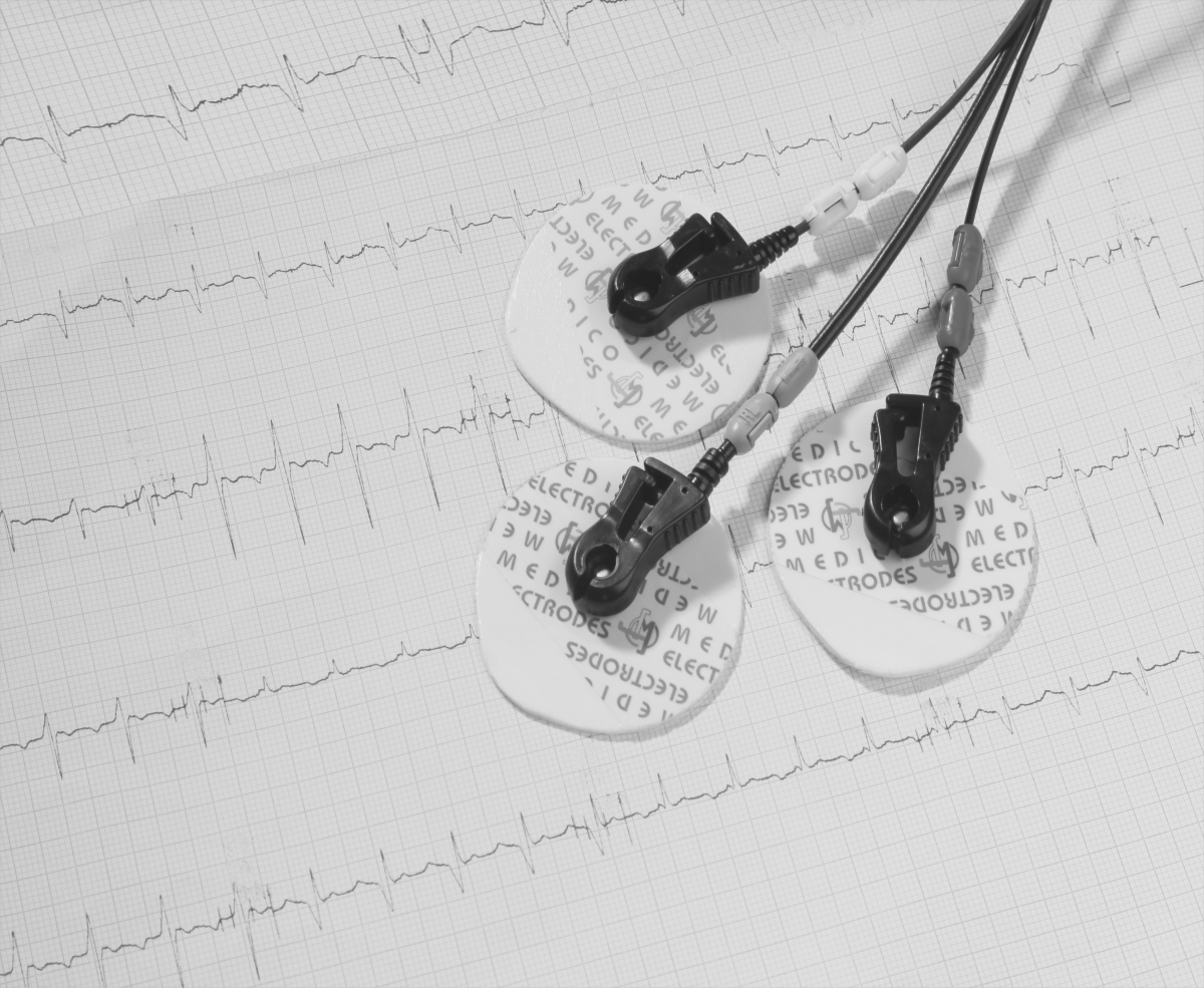 What Are the Benefits of Wet Gel ECG Electrodes and Gel
